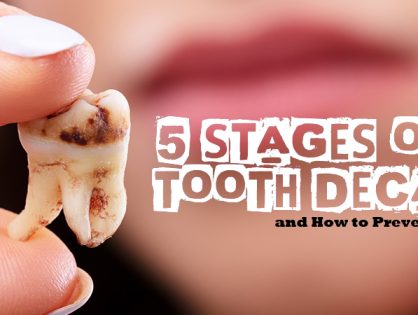 Oral Cancer: Symptoms and Their Solutions